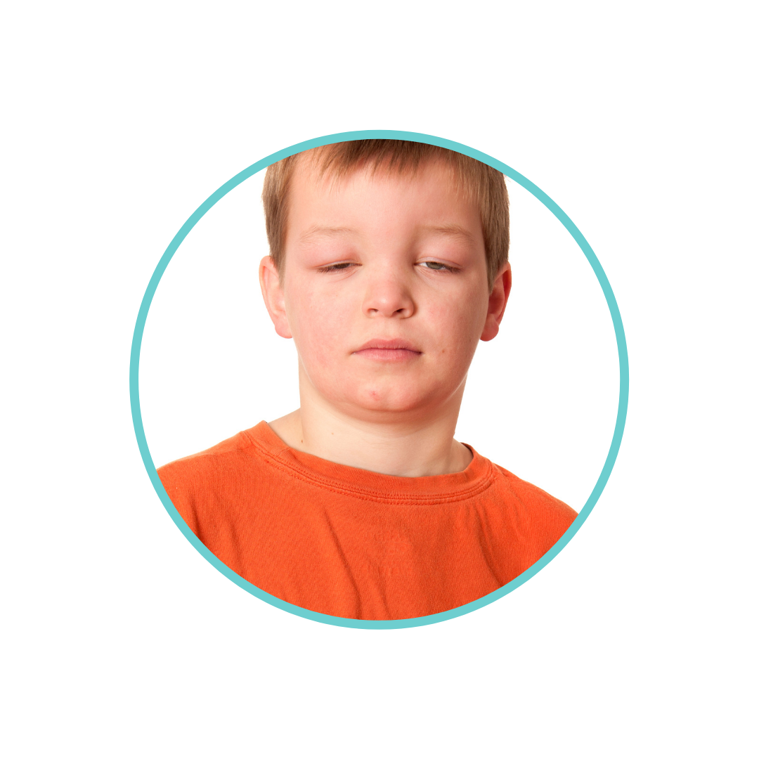 ¿Qué es un edema? ¿Qué tipo de edemas existen? - MMC CLINIC CENTER