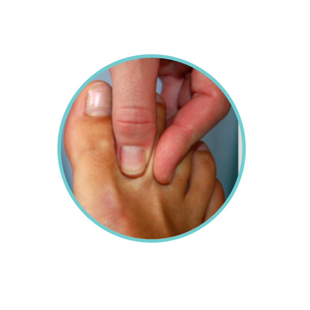 ¿Cómo evaluamos si es un edema? | MMC CLINIC CENTER